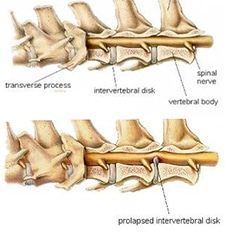 Back Surgery (for IVDD) - Advanced Veterinary Care